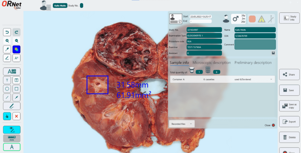 Gross Pathology: An In-depth Overview – ORNet