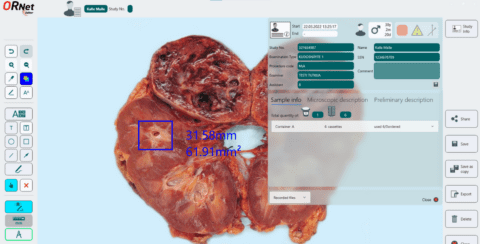 Gross Pathology: An In-depth Overview – ORNet