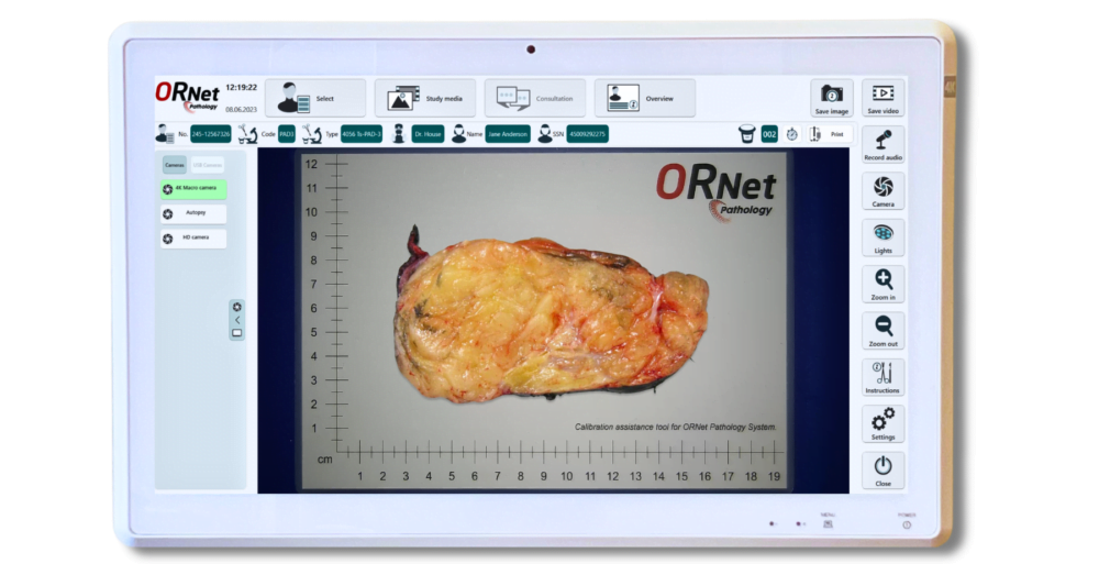 ORNet Pathology- New Display – ORNet